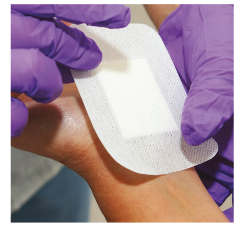 Medical Adhesive Tapes Applications for Custom Die Cutting | JBC ...